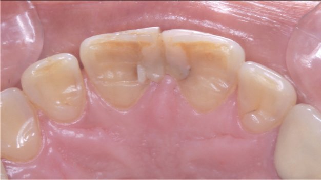 Online Open Access Dental Magazine, Journal, Publication, Dentistry Journal