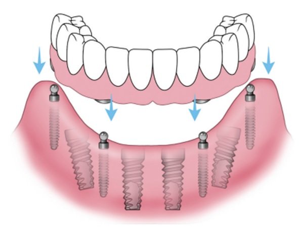 Online Open Access Dental Magazine, Journal, Publication, Dentistry Journal