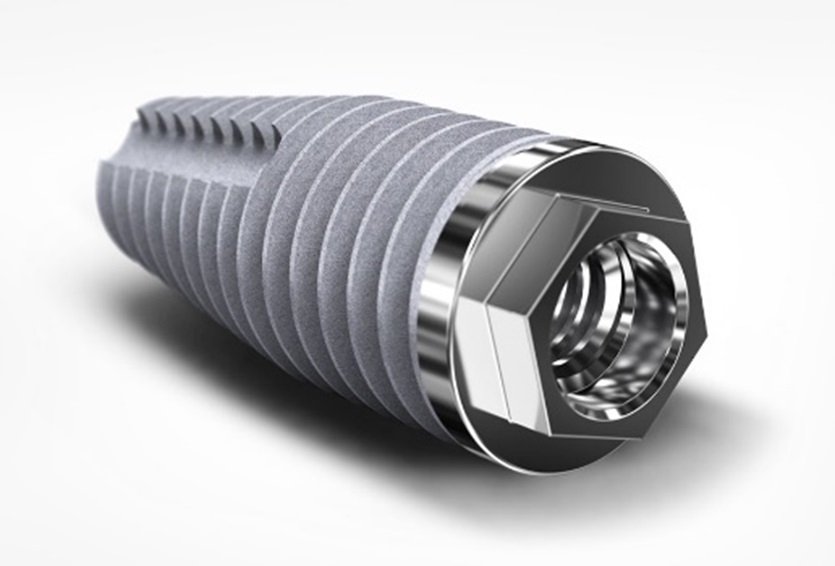 ABUTMENT SELECTION FOR ANTERIOR IMPLANTS