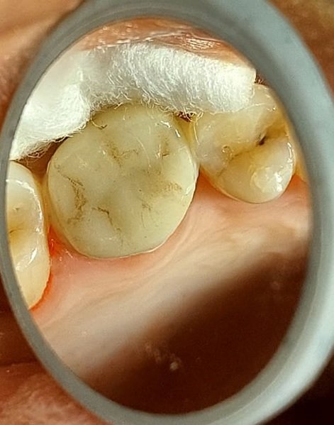 Online Open Access Dental Magazine, Journal, Publication, Dentistry Journal