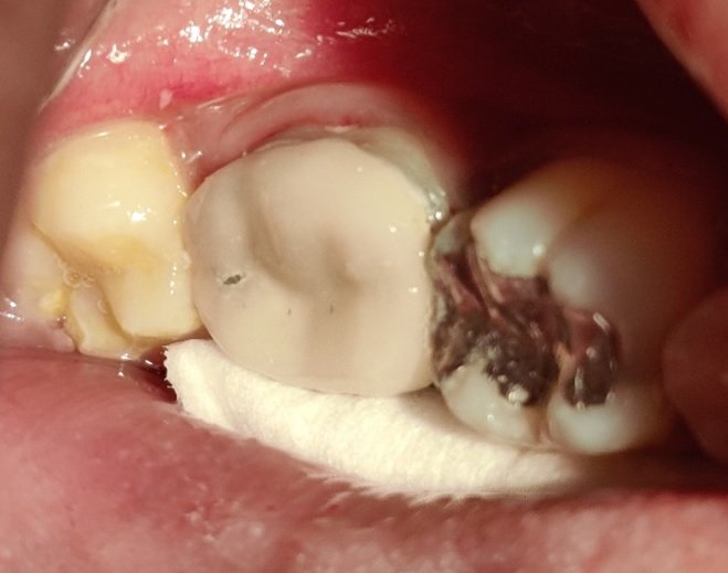 Online Open Access Dental Magazine, Journal, Publication, Dentistry Journal