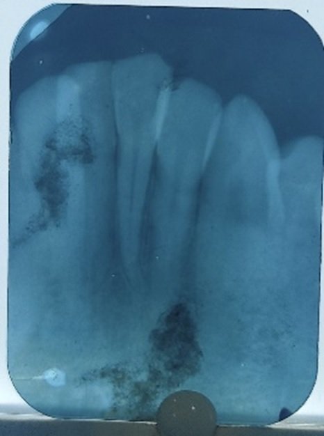 Guident : OPEN ACCESS DENTAL JOURNAL