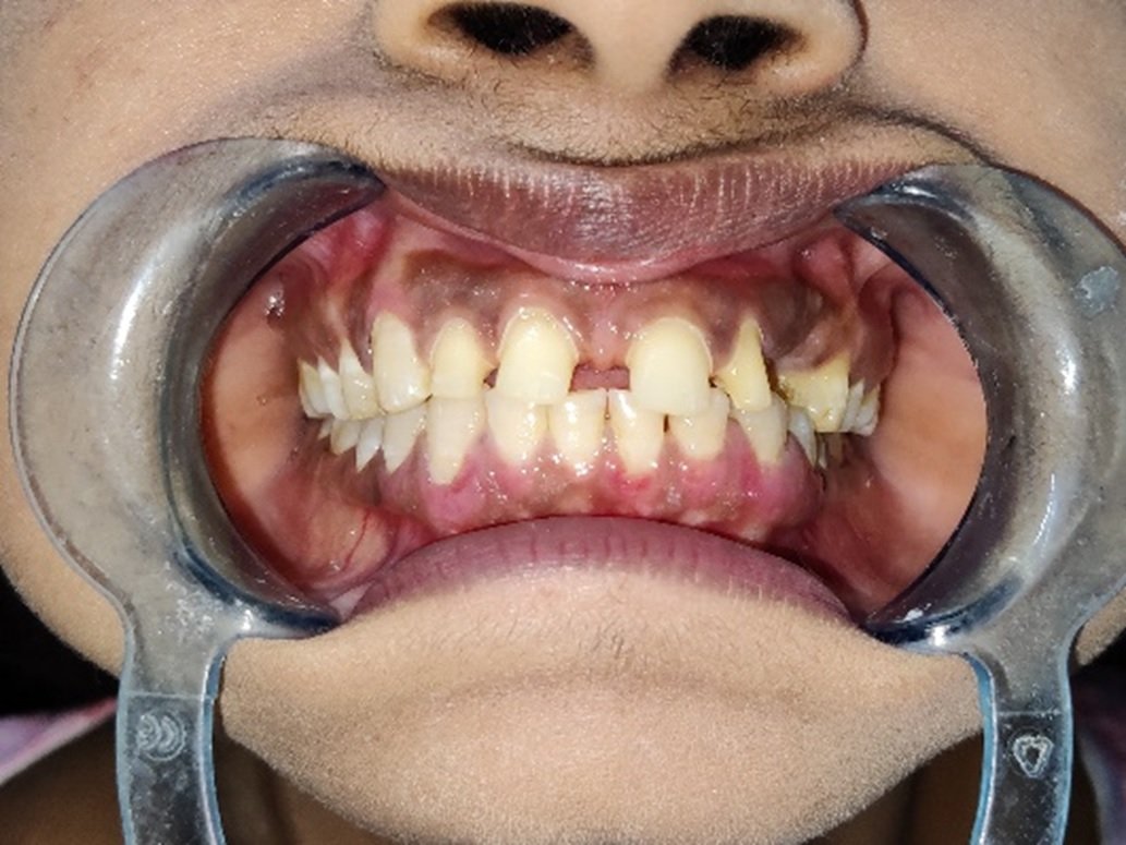 Online Open Access Dental Magazine, Journal, Publication, Dentistry Journal