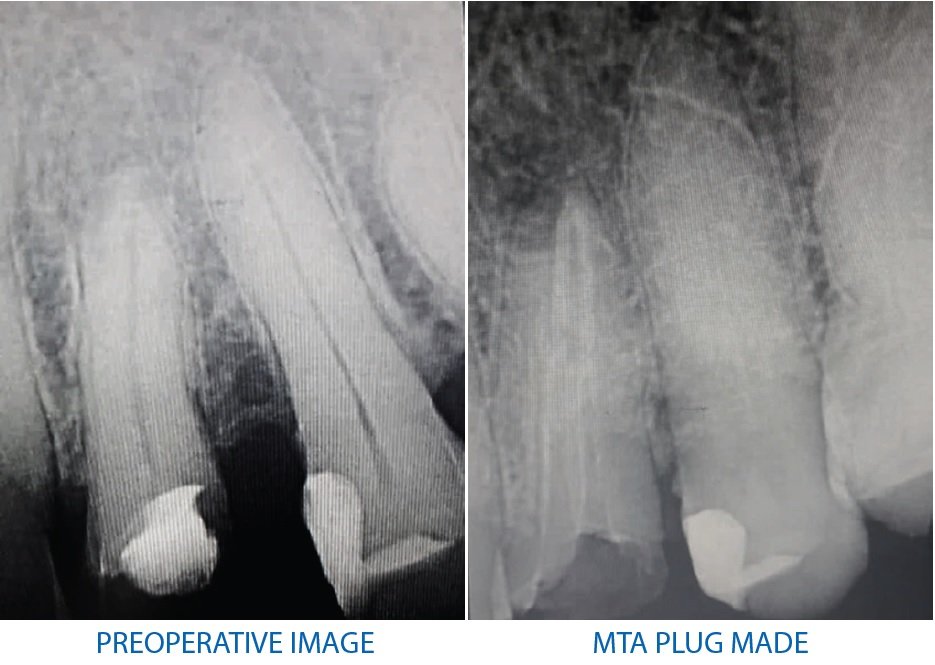 Guident : OPEN ACCESS DENTAL JOURNAL