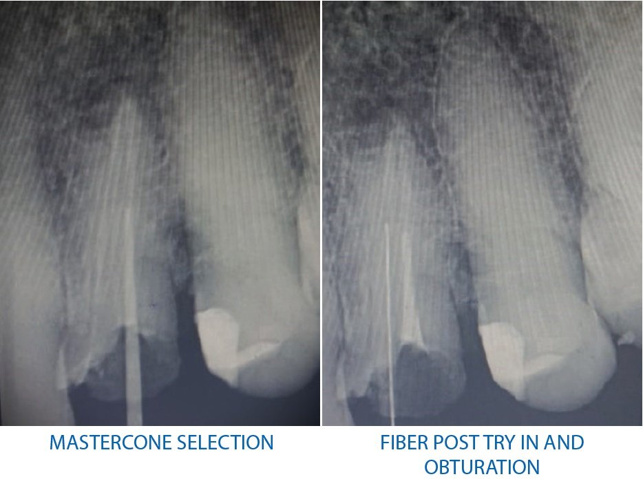 Guident : OPEN ACCESS DENTAL JOURNAL