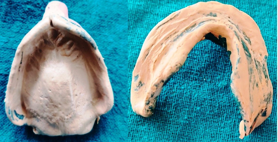 Guident : OPEN ACCESS DENTAL JOURNAL
