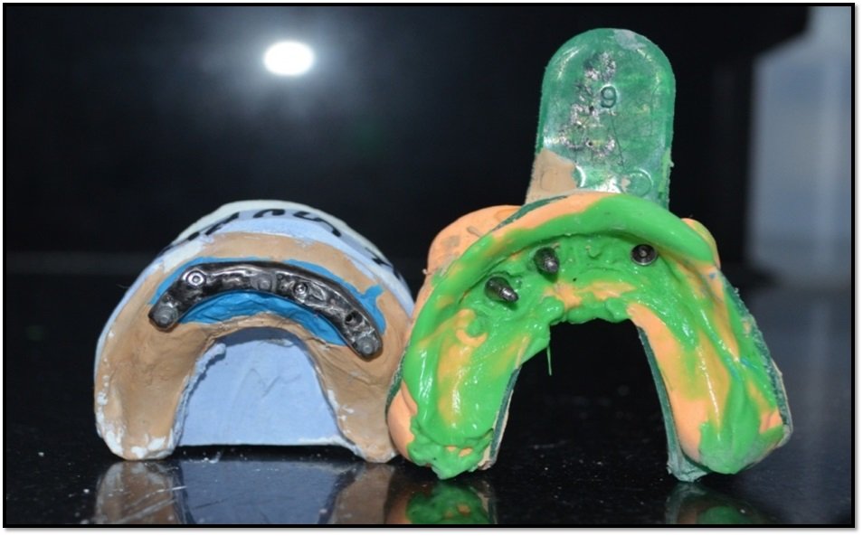 Guident : OPEN ACCESS DENTAL JOURNAL