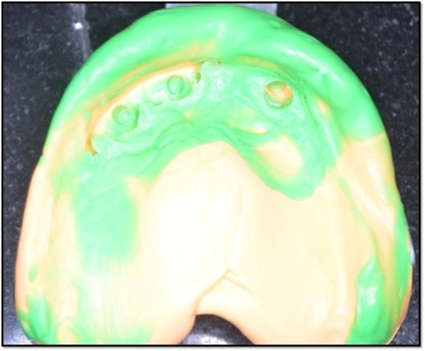 Guident : OPEN ACCESS DENTAL JOURNAL