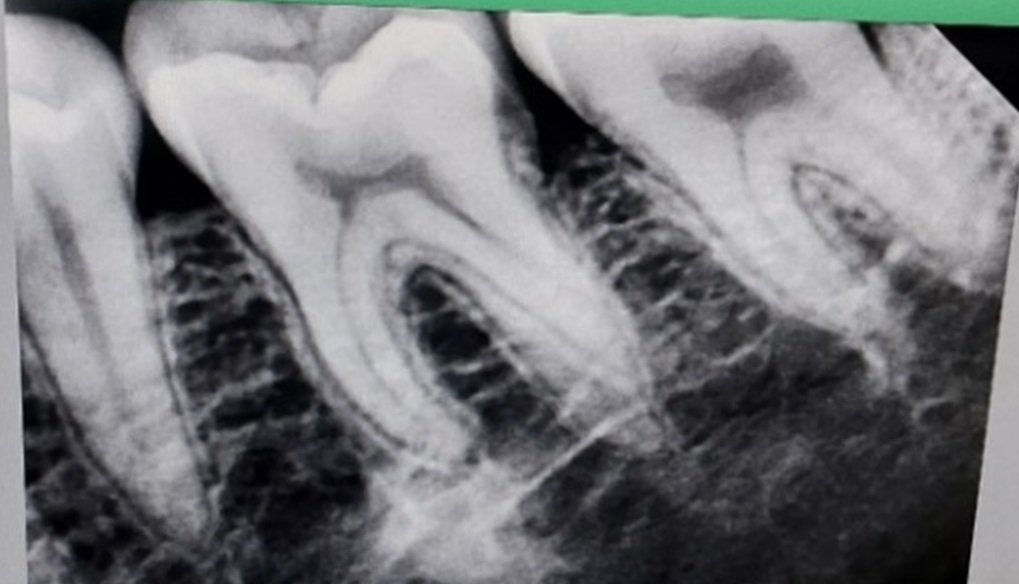 Online Open Access Dental Magazine, Journal, Publication, Dentistry Journal