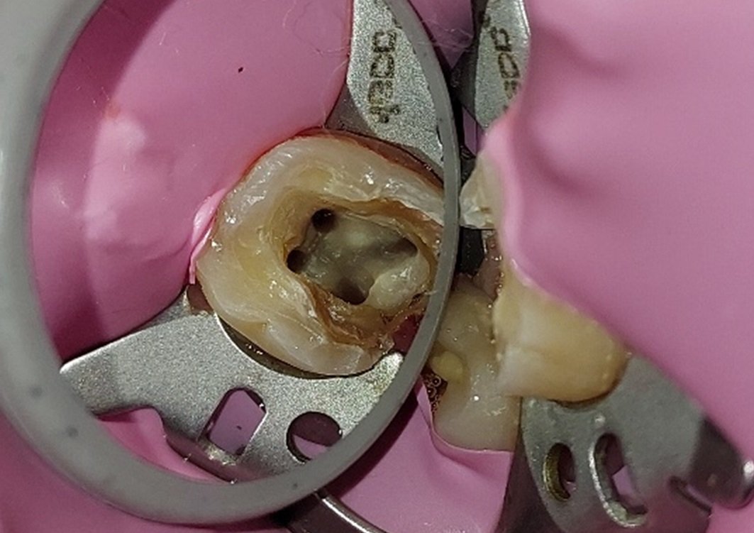 Online Open Access Dental Magazine, Journal, Publication, Dentistry Journal