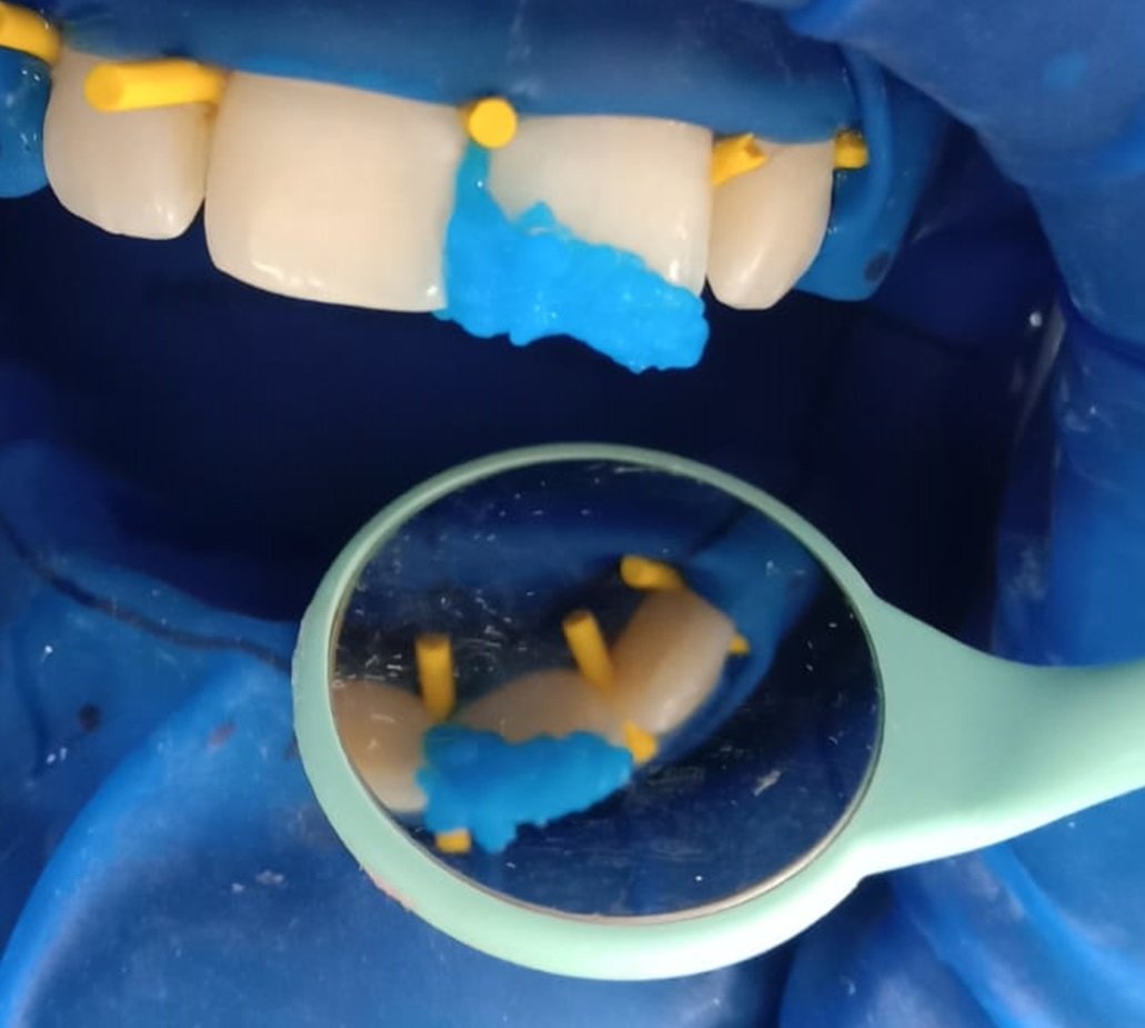 Guident : OPEN ACCESS DENTAL JOURNAL