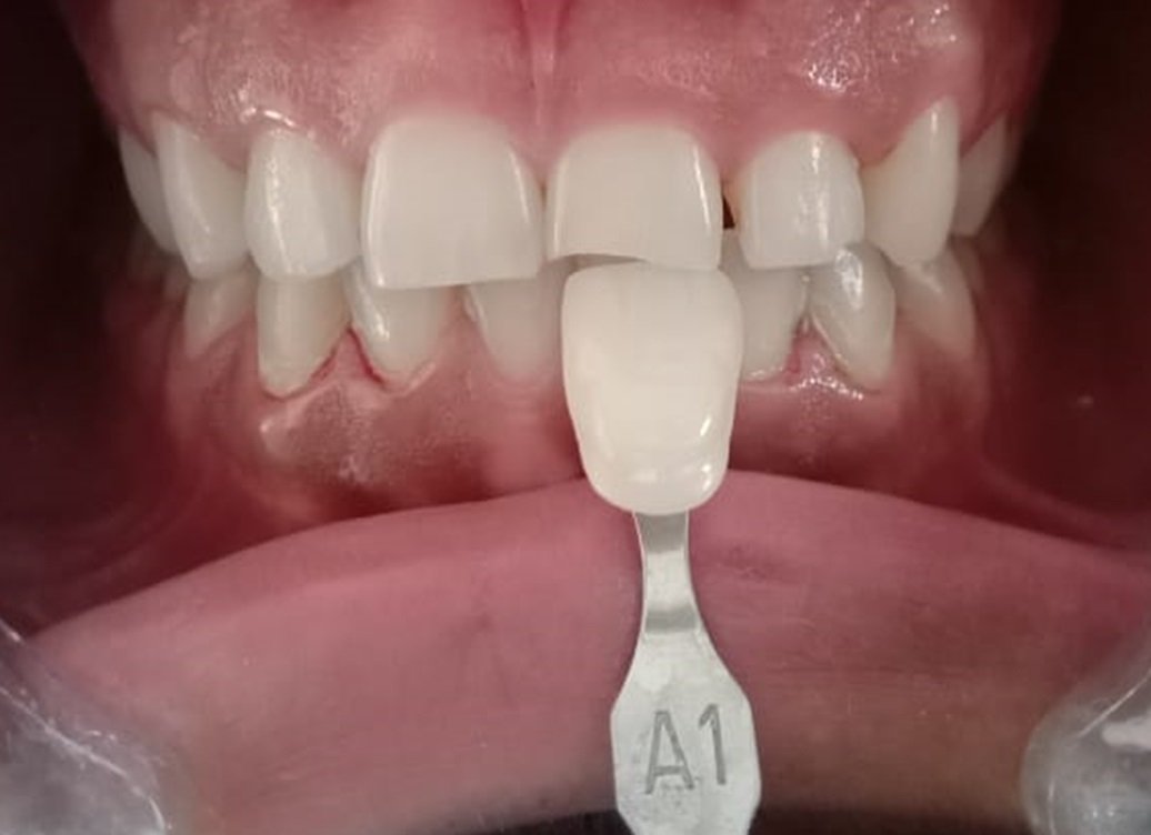 Guident : OPEN ACCESS DENTAL JOURNAL