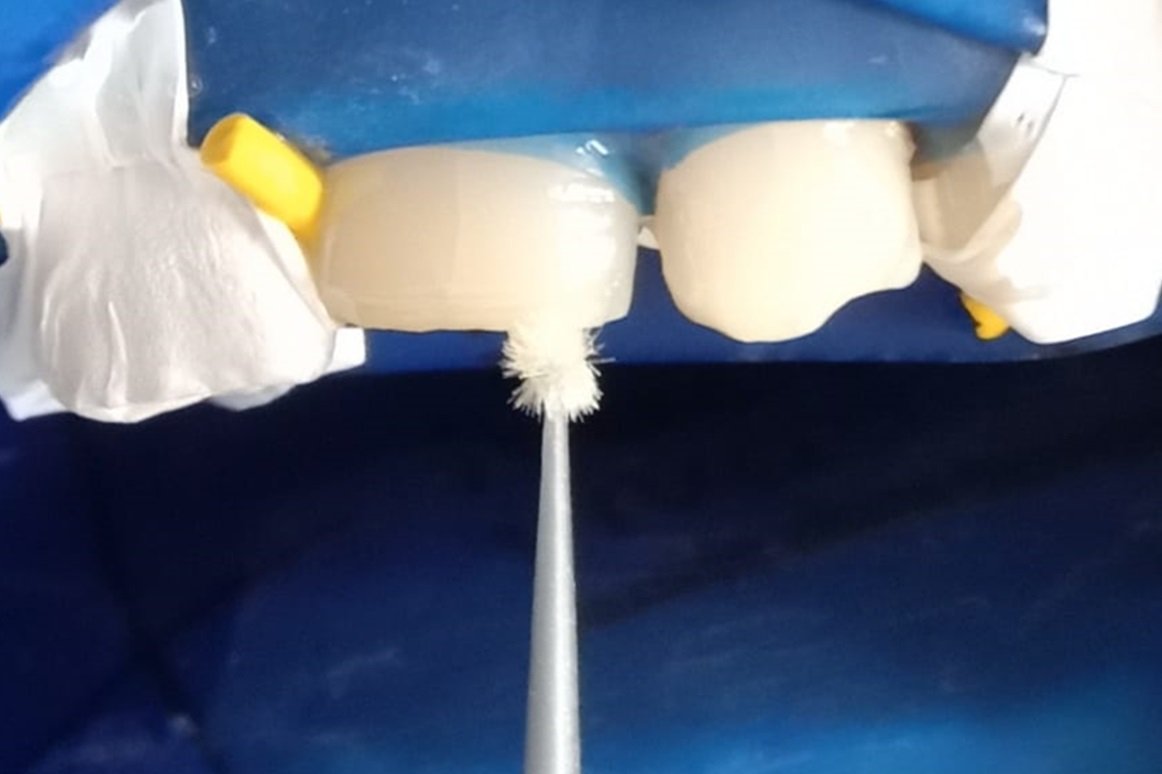 Guident : OPEN ACCESS DENTAL JOURNAL