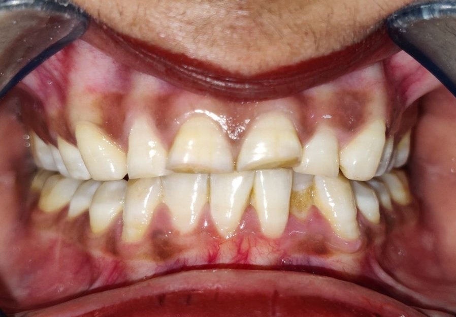 Online Open Access Dental Magazine, Journal, Publication, Dentistry Journal