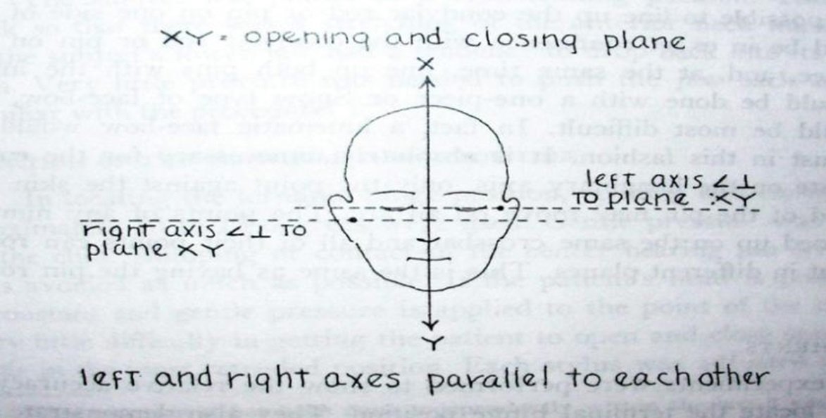 CRACKING THE CODE: TERMINAL HINGE AXIS DEMYSTIFIED AMIDST CONCEPTUAL ...