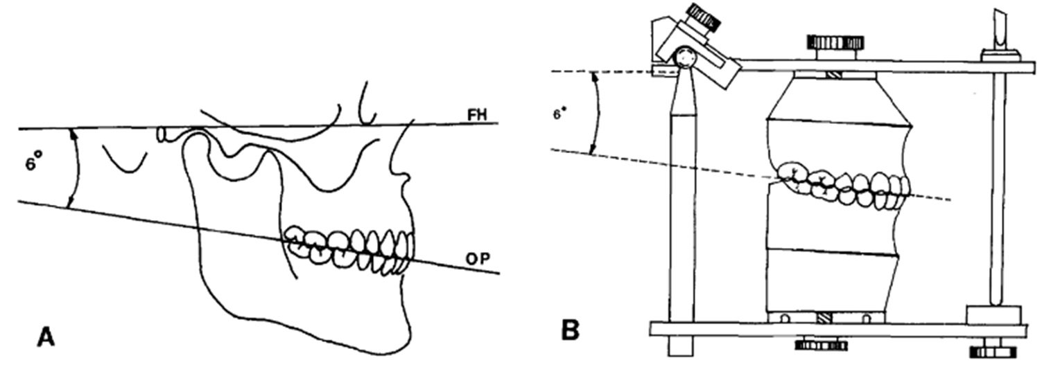 CRACKING THE CODE: TERMINAL HINGE AXIS DEMYSTIFIED AMIDST CONCEPTUAL ...