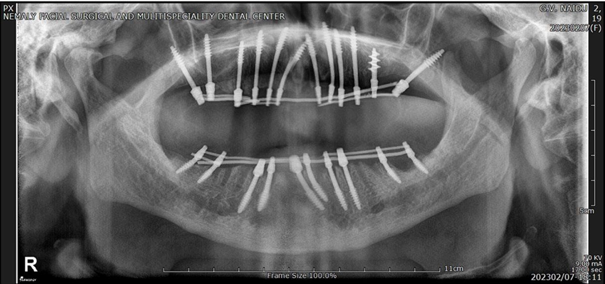 Guident : OPEN ACCESS DENTAL JOURNAL