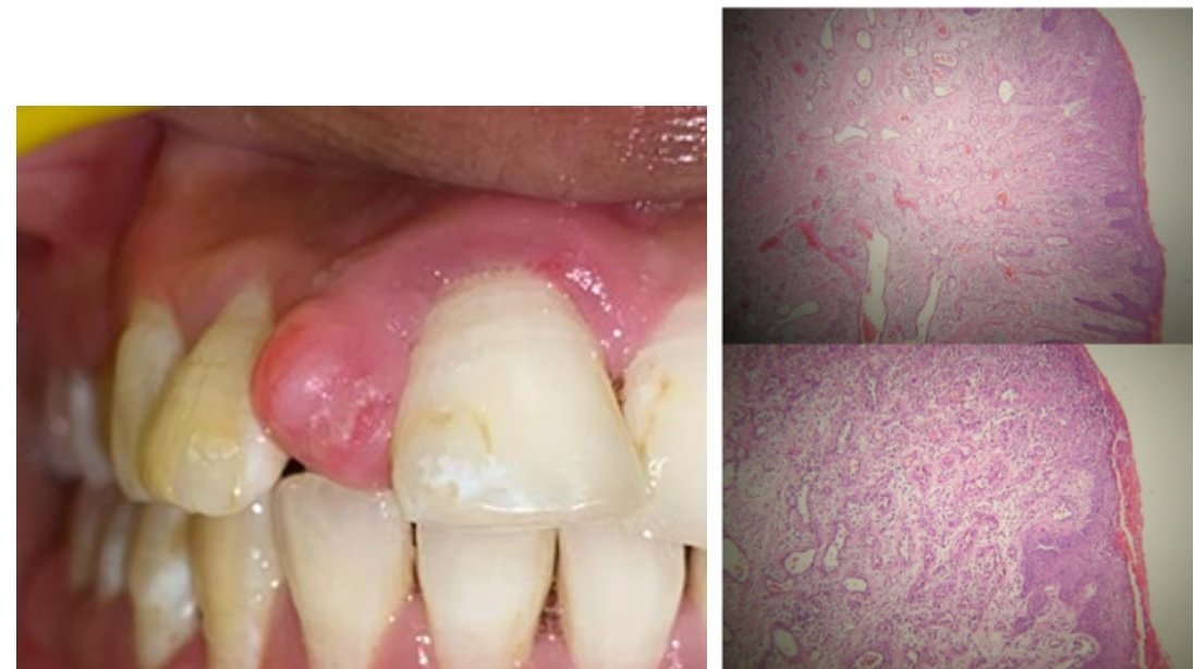 Online Open Access Dental Magazine, Journal, Publication, Dentistry Journal