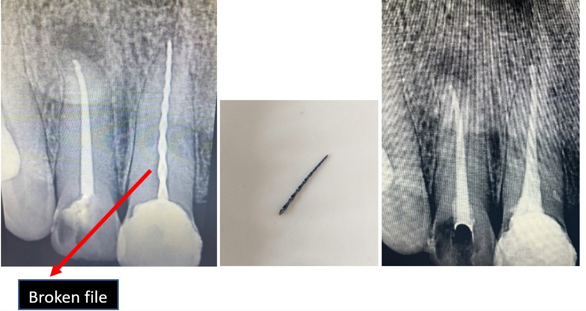 Guident : OPEN ACCESS DENTAL JOURNAL